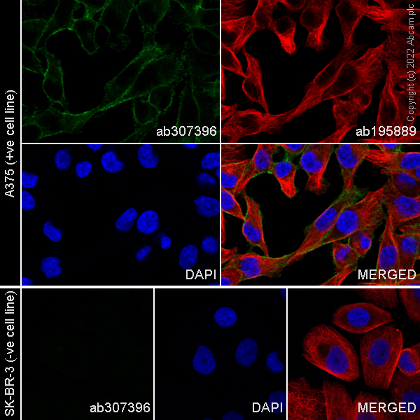 Alexa Fluor® 488 Anti-NG2 antibody [EPR22410-145] (ab307396) | Abcam