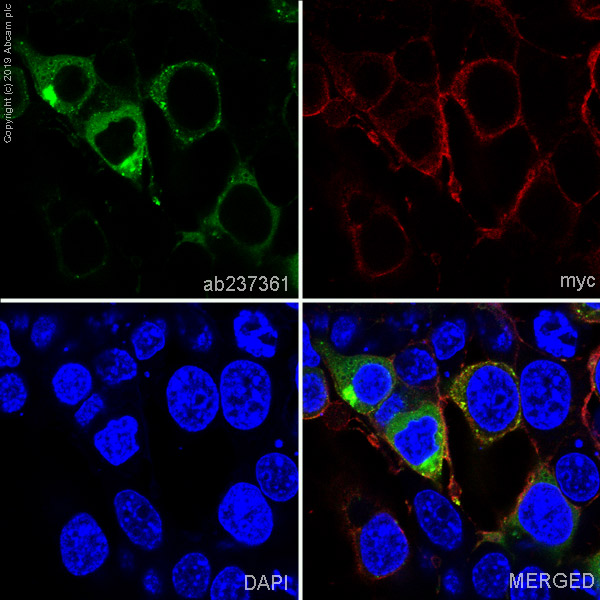 Anti-RAGE Alexa Fluor® 488 antibody [EPR21171] (ab237361) IgG | Abcam
