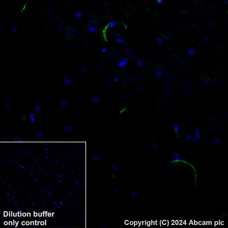 Alexa Fluor® 488 Anti-Transferrin Receptor antibody [EPR20584 ...