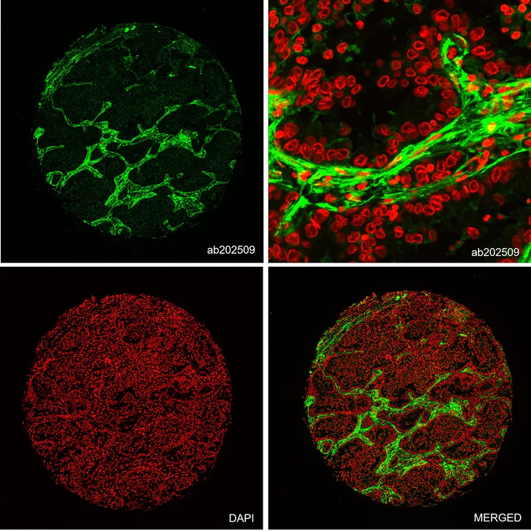 Alexa Fluor® 555 conjugated Anti-alpha smooth muscle Actin antibody ...