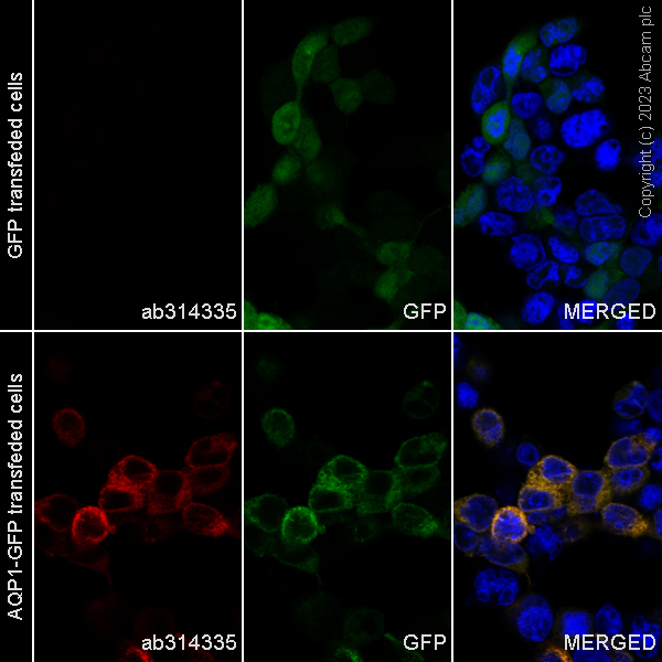 Alexa Fluor® 555 Anti-Aquaporin 1 antibody [EPR11588(B)] (ab314335) | Abcam