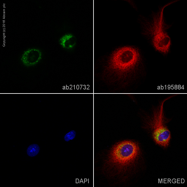 Alexa Fluor® 555 Anti-ATP synthase C antibody [EPR13907] (ab210732) | Abcam