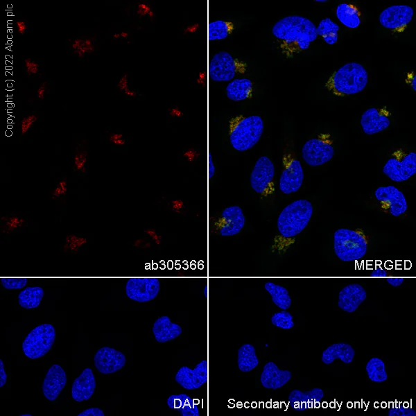 Anti-BDNF Alexa Fluor® 555 antibody [EPR1292] (ab305366) IgG | Abcam