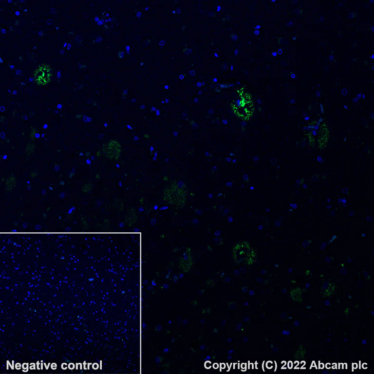 Anti-beta Amyloid 1-42 Alexa Fluor® 555 antibody [mOC64] (ab302544) | Abcam