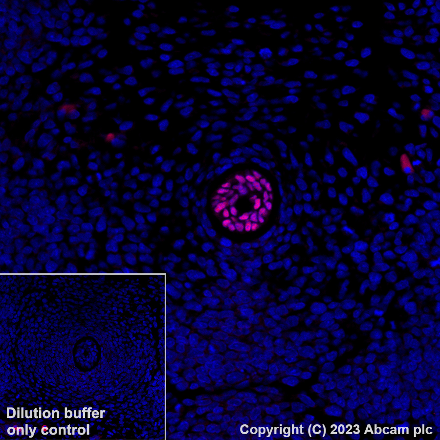 Alexa Fluor® 555 Anti-Brachyury / Bry antibody [EPR18113] (ab314675 ...