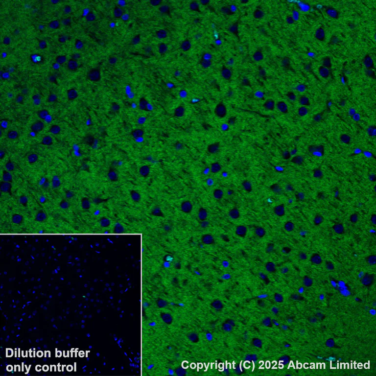 Alexa Fluor® 555 Anti-Calcium Pump PMCA2 ATPase antibody [EPR28923-56 ...