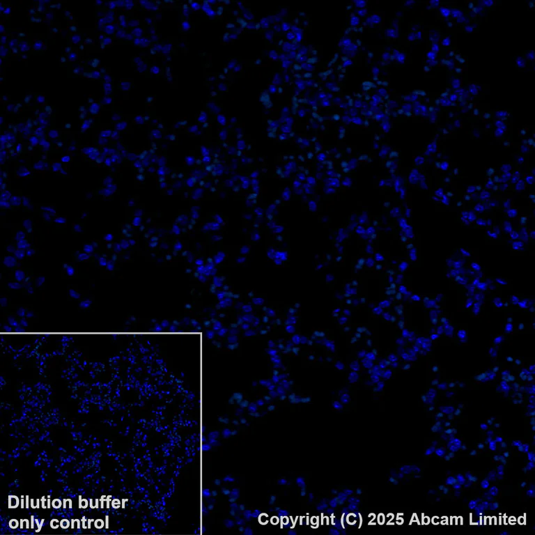 Alexa Fluor® 555 Anti-Calcium Pump PMCA2 ATPase antibody [EPR28923-56 ...