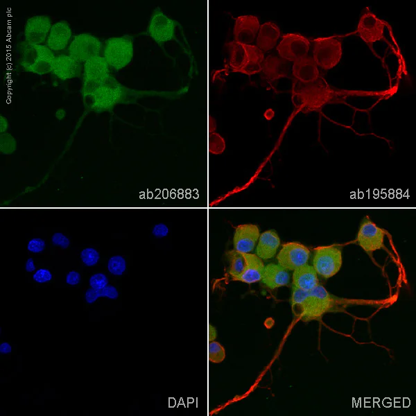 Alexa Fluor® 555 Anti-CaMKII antibody [EP1829Y] (ab206883) | Abcam