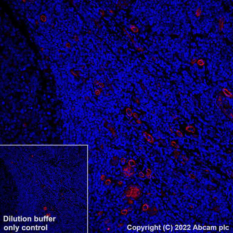 Alexa Fluor® 555 Anti-CD146 antibody [EPR3208] (ab307390) | Abcam