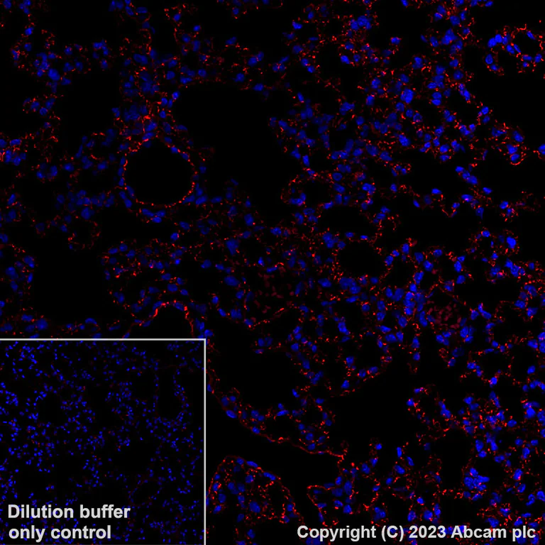 Alexa Fluor® 555 Anti-CD31 antibody [EPR17259] (ab312892) | Abcam
