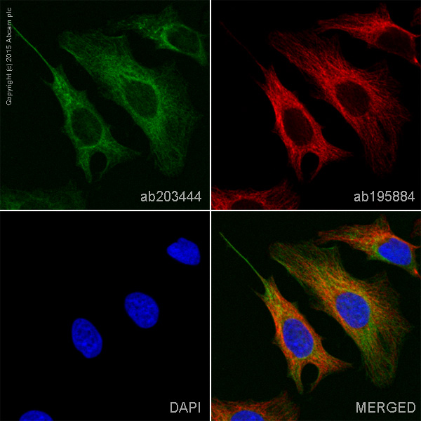 Alexa Fluor® 555 conjugated Anti-Cytokeratin 19 antibody [EP1580Y ...