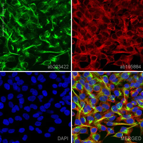 Anti-Desmin - Cytoskeleton Marker Alexa Fluor® 555 antibody [Y66 ...