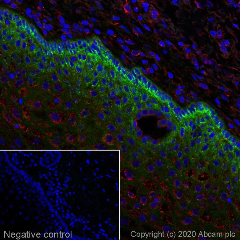 Alexa Fluor® 555 Anti-EGFR抗体[EP38Y] (ab274892)| Abcam中文官网