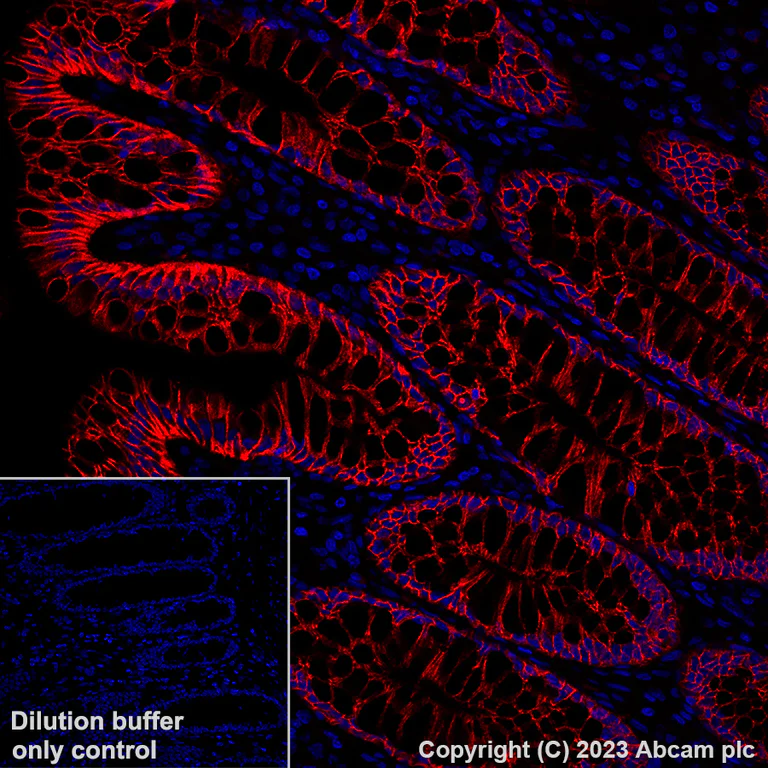 Alexa Fluor® 555 Anti-EpCAM antibody [EPR20532-222] (ab313668) | Abcam
