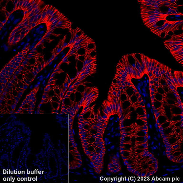 Alexa Fluor® 555 Anti-EpCAM antibody [EPR20532-222] (ab313668) | Abcam