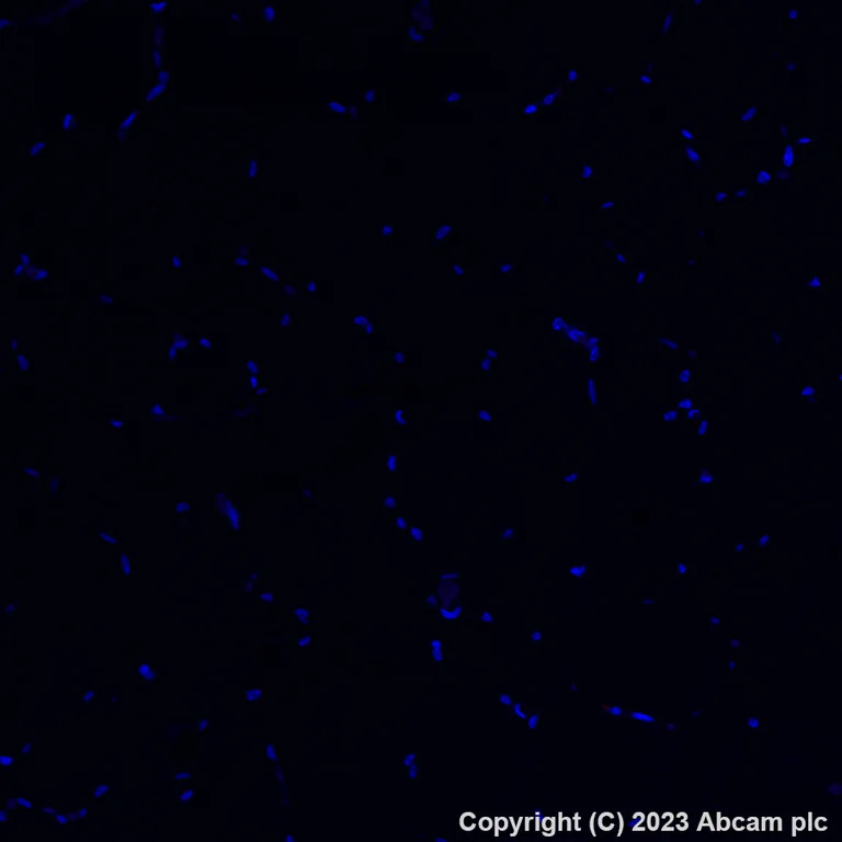 Alexa Fluor® 555 Anti-EpCAM antibody [EPR20532-222] (ab313668) | Abcam