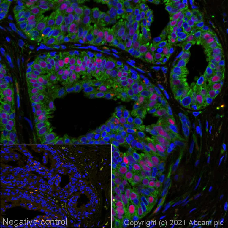 Alexa Fluor® 555 Anti-Estrogen Receptor alpha antibody [EPR4097 ...