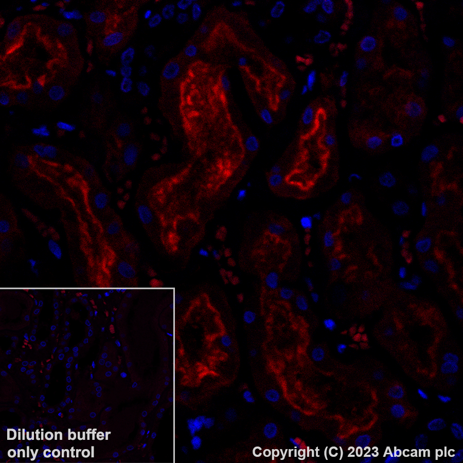 Alexa Fluor® 555 Anti-Folate Binding Protein/FBP antibody [EPR20277 ...