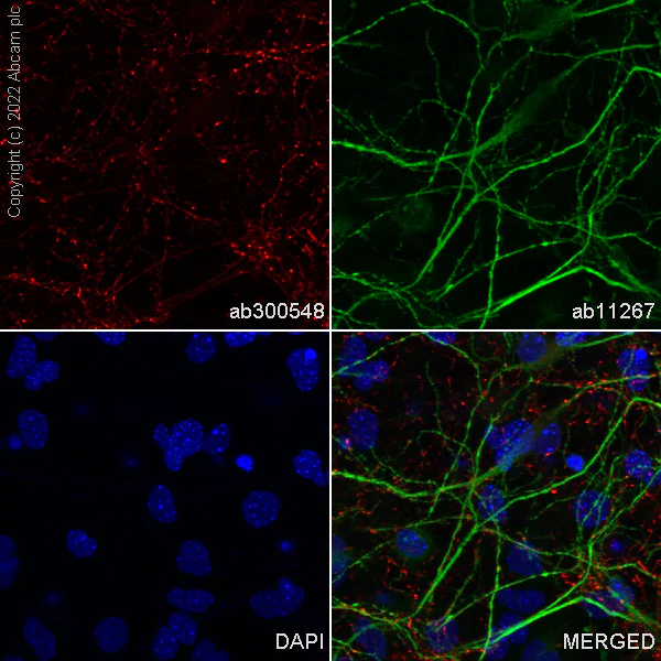 Anti-GAD65 Alexa Fluor® 555 antibody [EPR22952-70] (ab300548) IgG | Abcam