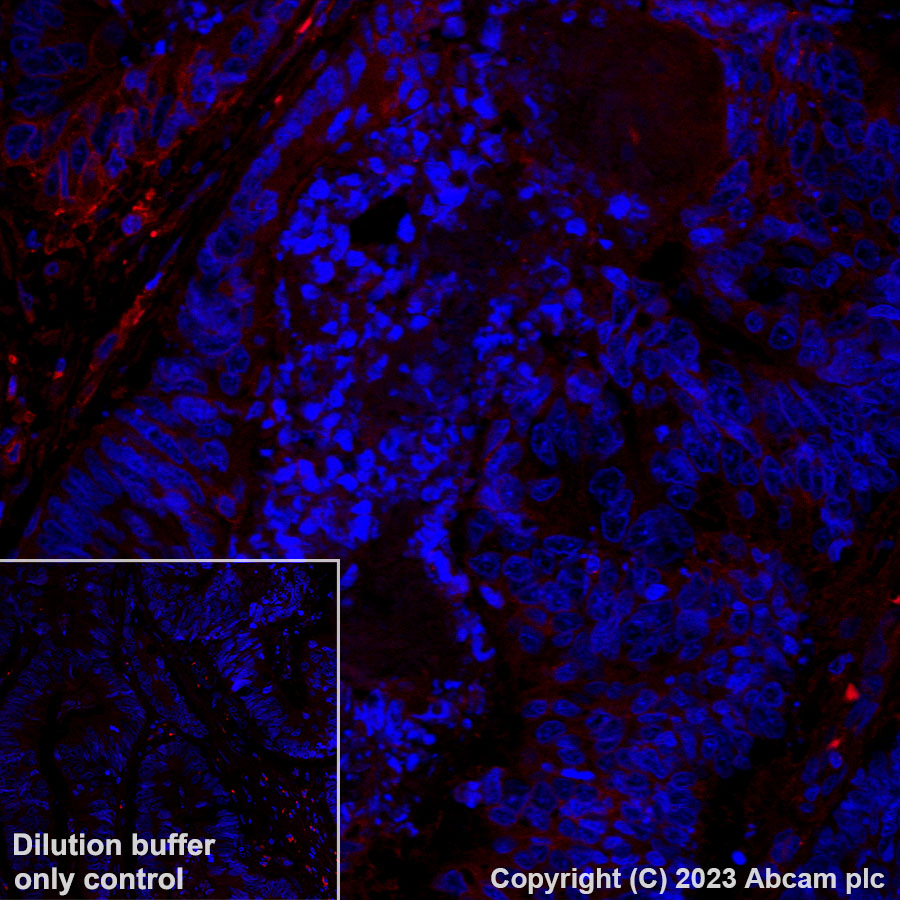 Alexa Fluor® 555 Anti-HLA Class 1 ABC antibody [EPR22172] (ab314336 ...