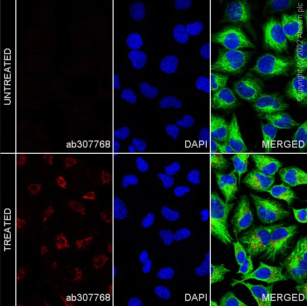 Alexa Fluor® 555 Anti-LC3B - Autophagosome Marker antibody [EPR18709] (ab307768) | Abcam