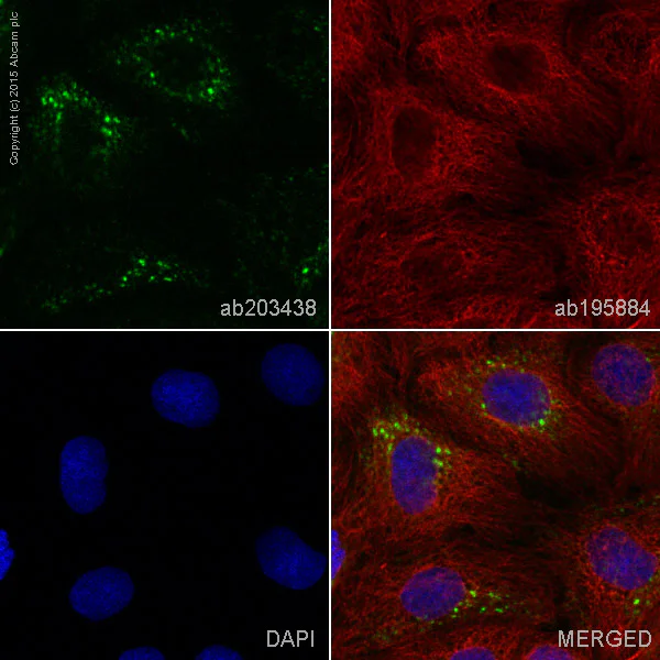 Alexa Fluor® 555 Anti-M6PR (cation independent)抗体[EPR6599] - Lysosome ...