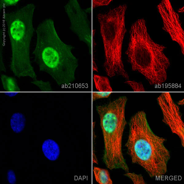 Alexa Fluor® 555 Anti-Mad2L2/REV7 antibody [EPR13657] (ab210653) | Abcam
