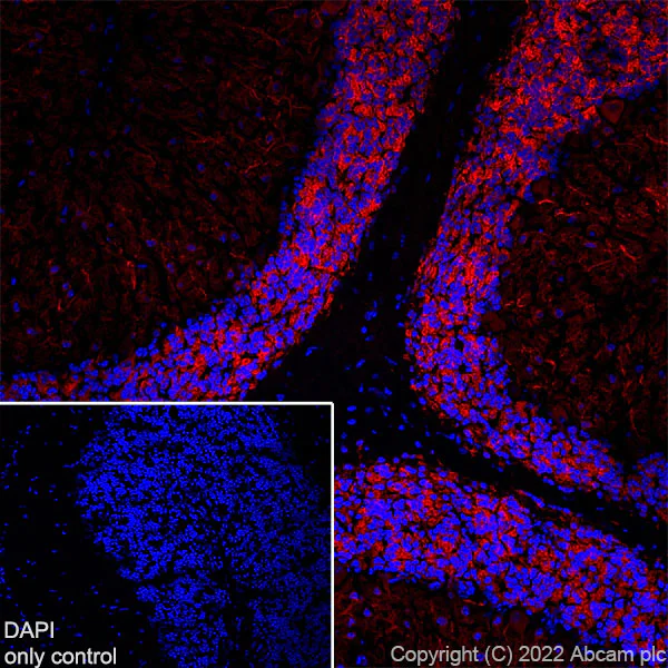 Anti-MAP2 Alexa Fluor® 555 antibody [EPR19691] (ab302547) IgG | Abcam