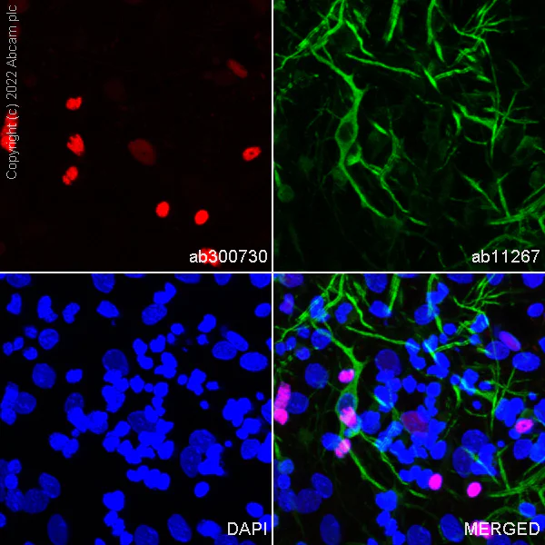 Alexa Fluor® 555 Anti-Olig2抗体[EPR2673] (ab300730)| Abcam中文官网