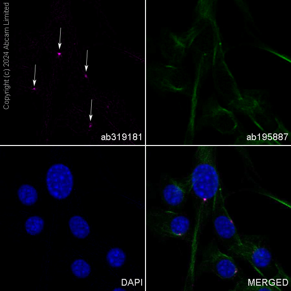Alexa Fluor® 555 Anti-Pericentrin antibody [EPR21987] - Centrosome ...
