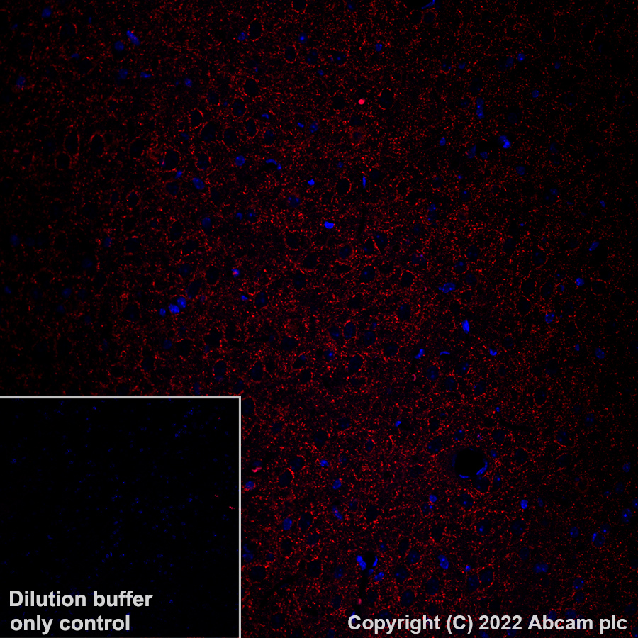 Anti-GAD67/GAD1 Alexa Fluor® 555 antibody [EPR20578] (ab306572) Rabbit ...