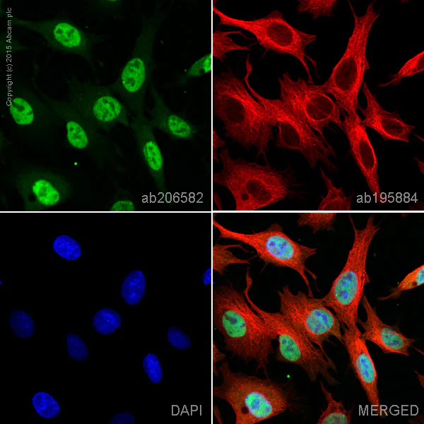 Alexa Fluor® 555 Anti-Smad3抗体[EP568Y] (ab206582)| Abcam中文官网