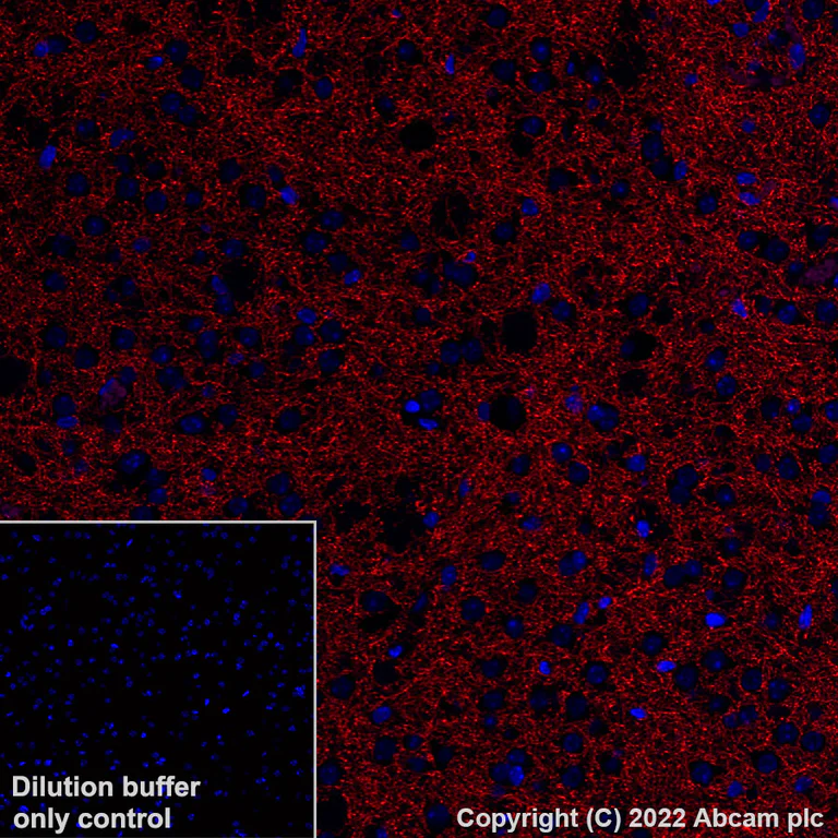 Anti-Tyrosine Hydroxylase Alexa Fluor® 555 antibody [EP1532Y] (ab305365 ...
