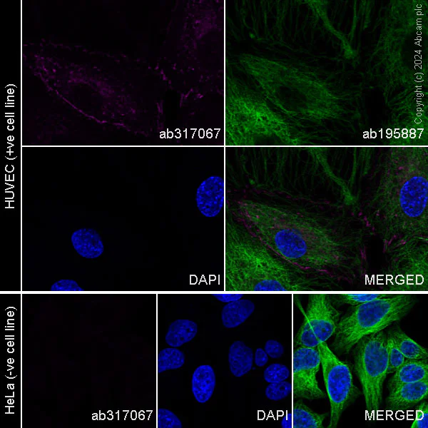 Alexa Fluor® 555 Anti-VE Cadherin antibody [EPR27436-55] (ab317067) | Abcam
