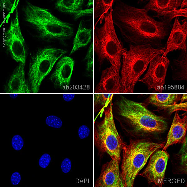 Alexa Fluor® 555 conjugated Anti-Vimentin antibody [EPR3776 ...