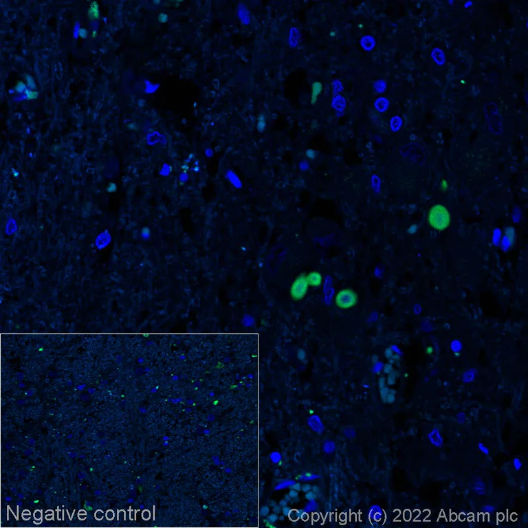 Alexa Fluor® 568 Anti-Alpha-synuclein (phospho S129) antibody [EP1536Y ...