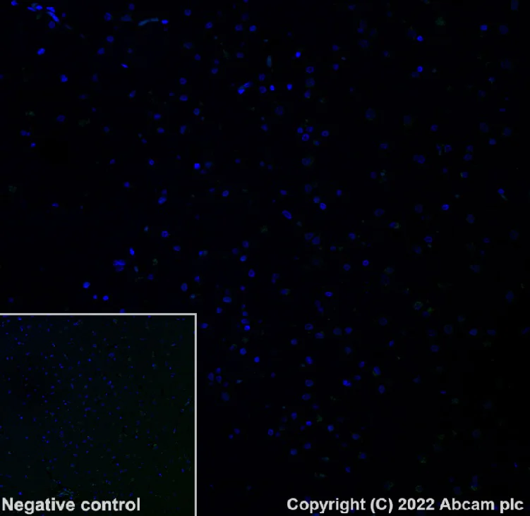 Alexa Fluor® 568 Anti-beta Amyloid 1-42 antibody [mOC64] (ab302803) | Abcam