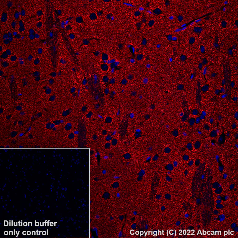 Alexa Fluor® 568 Anti-EAAT2 antibody [EPR19798] (ab313820) | Abcam