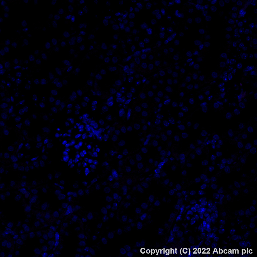 Alexa Fluor® 568 Anti-EAAT2 antibody [EPR19798] (ab313820) | Abcam