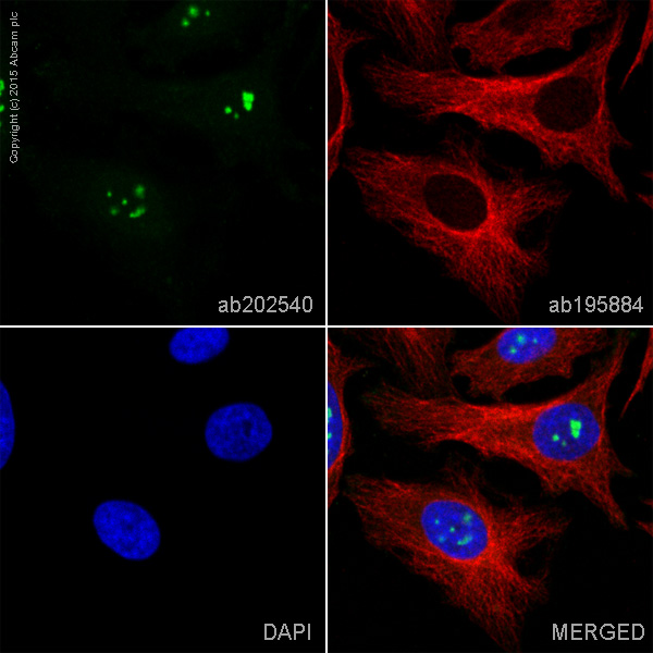 Fibrillarin抗体- Nucleolar Marker (ab5821)| Abcam中文官网