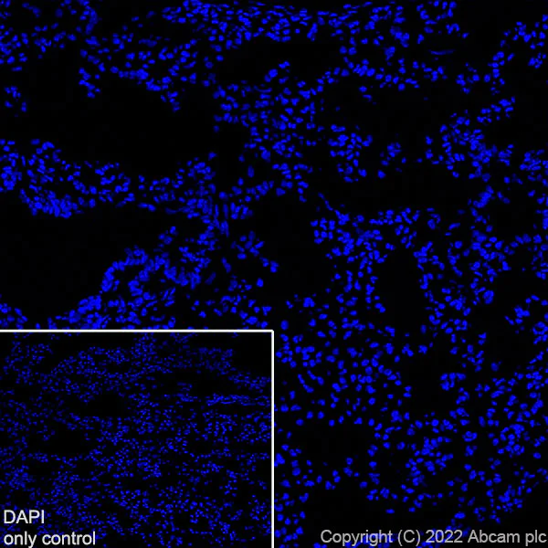 Alexa Fluor® 568 Anti-GAD65 antibody [EPR22952-70] (ab307856) | Abcam