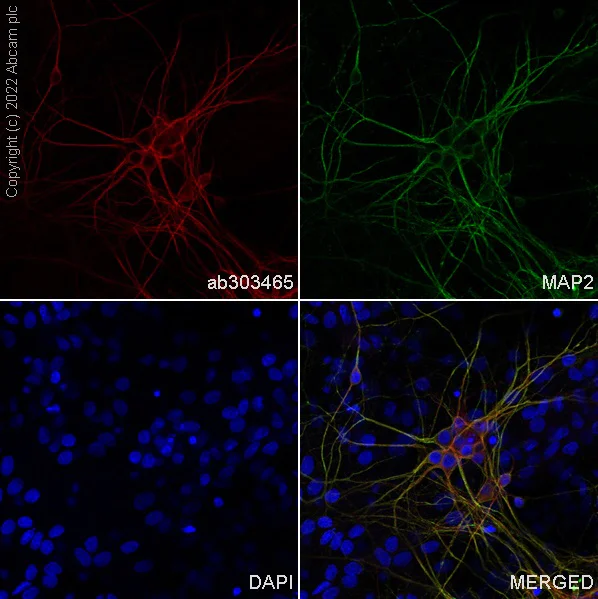 Alexa Fluor® 568 Anti-MAP2 antibody [EPR19691] - Neuronal Marker ...