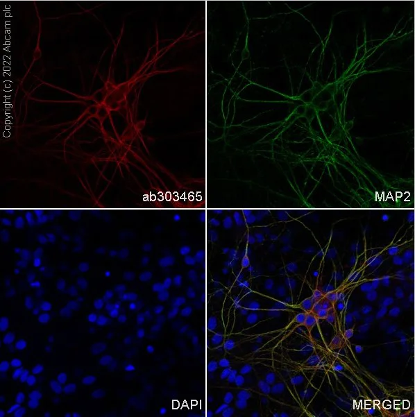 Alexa Fluor® 568 Anti-MAP2 antibody [EPR19691] - Neuronal Marker ...