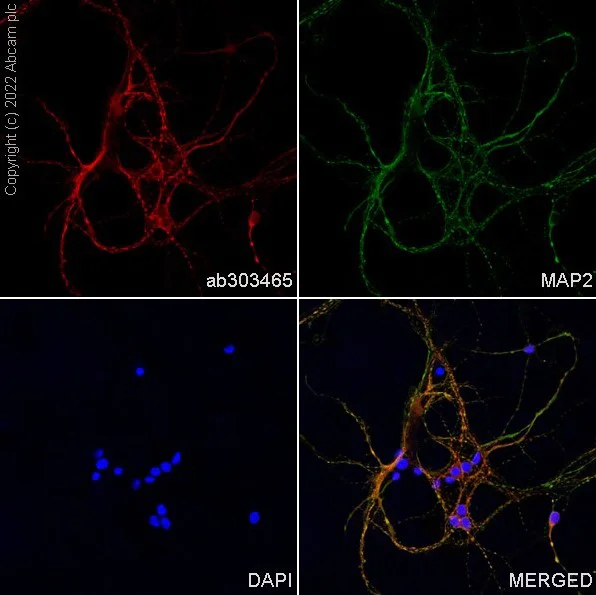 Alexa Fluor® 568 Anti-MAP2 antibody [EPR19691] - Neuronal Marker ...