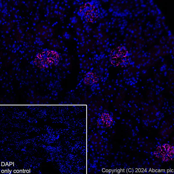 Alexa Fluor® 568 Anti-Nestin antibody [EPR22023] - Neural Stem Cell ...