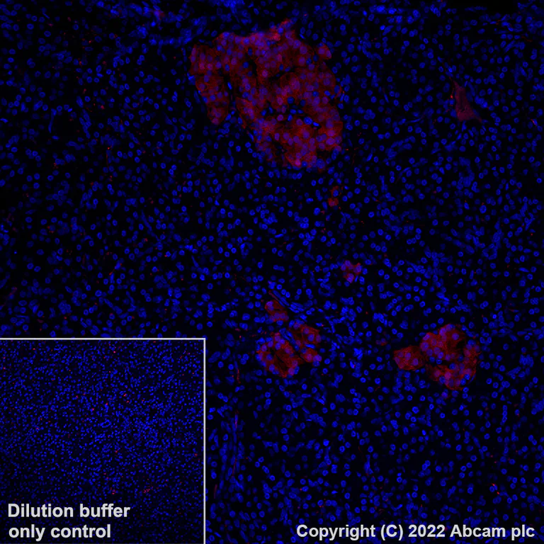 Alexa Fluor® 568 Anti-PGP9.5抗体[EPR4118] - Neuronal Marker (ab305109 ...