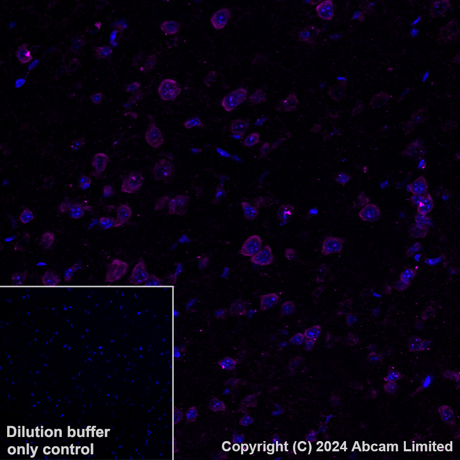 Alexa Fluor® 568 Anti-PSMA antibody [EPR28358-8] (ab320703) | Abcam