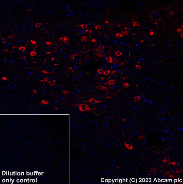 Alexa Fluor® 568 Anti-Tyrosine Hydroxylase antibody [EP1532Y ...