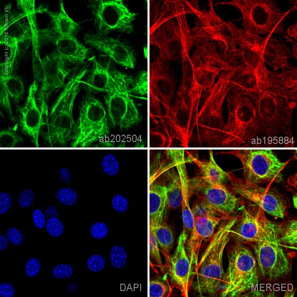 Anti-Vimentin Alexa Fluor® 568 antibody [EPR3776] (ab202504) IgG | Abcam