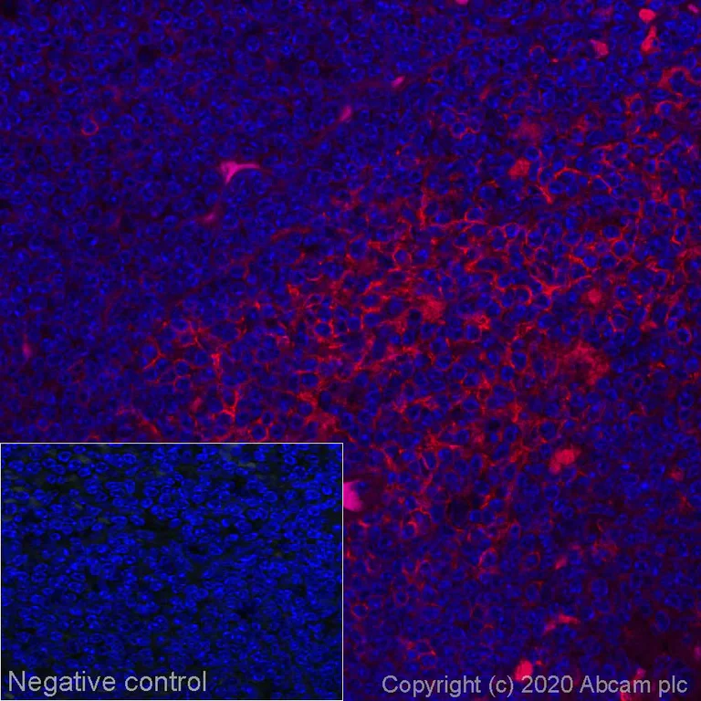 Alexa Fluor® 594 Anti-CD8 alpha antibody [EPR21769] (ab277939) | Abcam